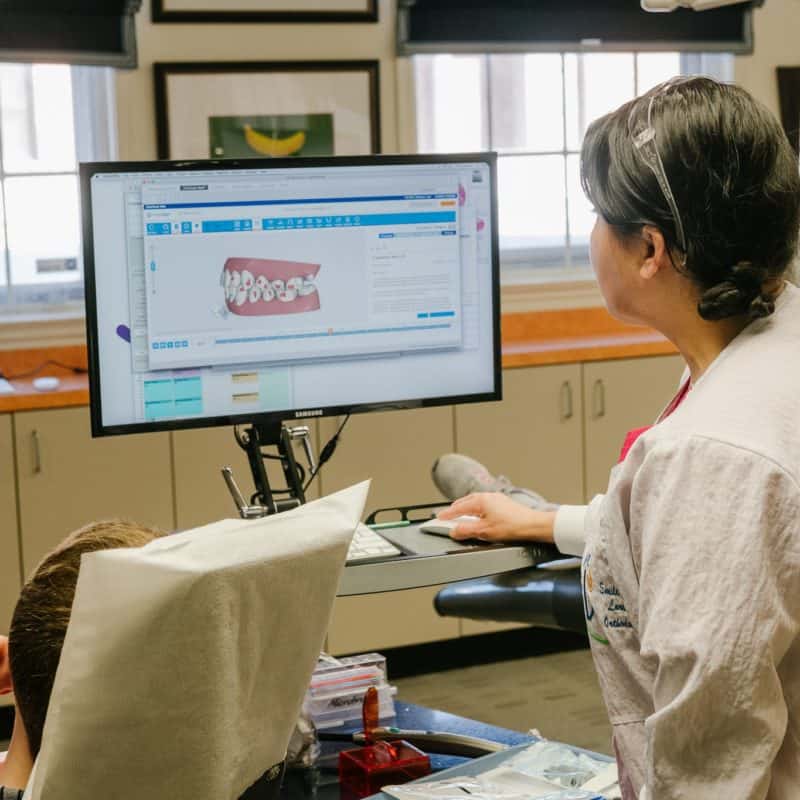 3M Advanced Metal Braces - Larson Orthodontics in Alexandria, VA