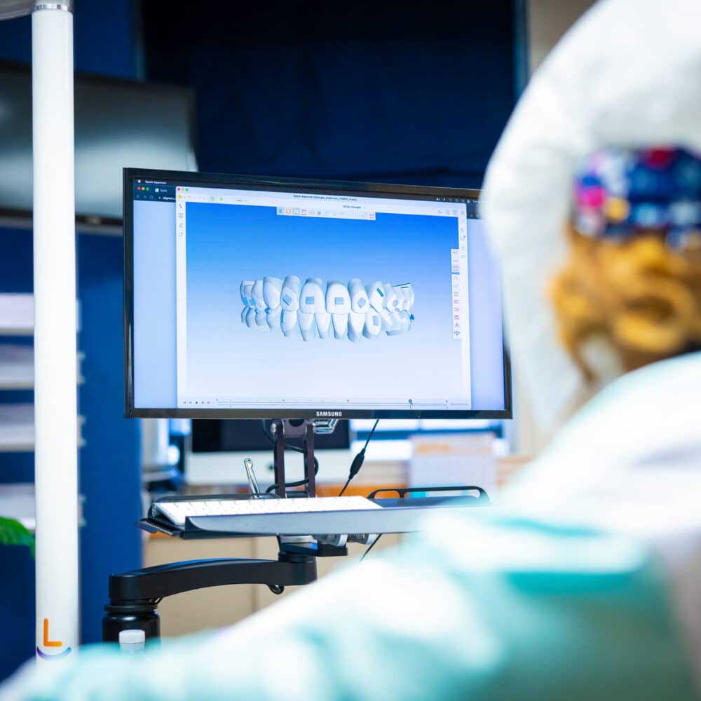 3M Clear Braces | Alexandria, VA | Larson Orthodontics